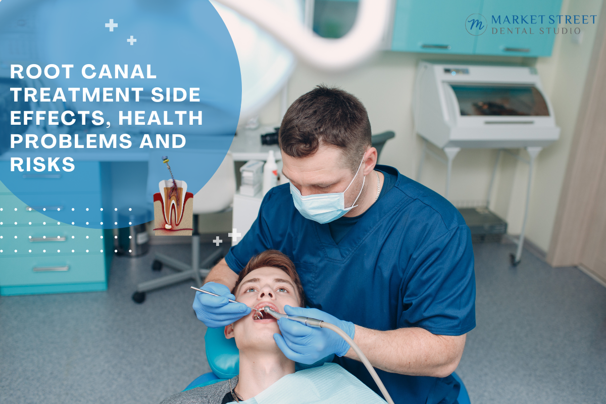 Understanding The Risks And Side Effects Of Root Canal